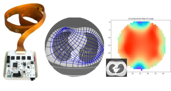 Spectra - Open Source Biomedical Imaging - Electronics-Lab