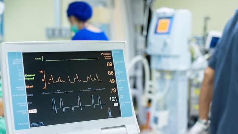 EKG monitor in intra aortic balloon pump machine. Medical equipment ...